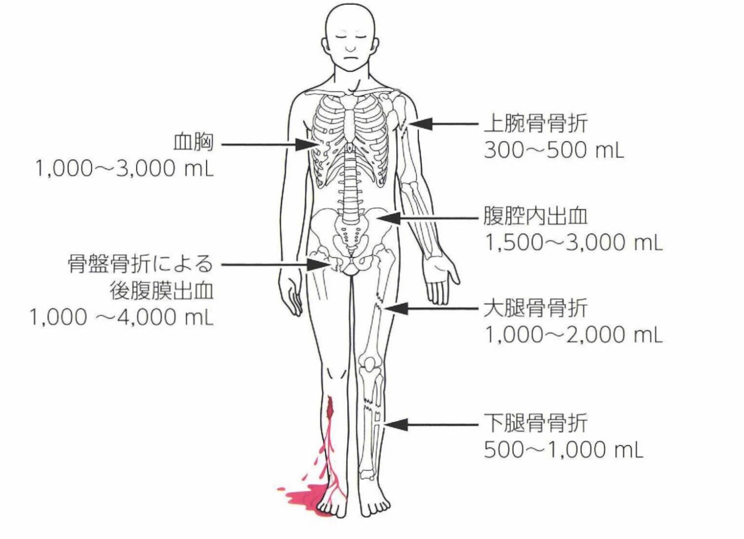 SALTAPSで考えよう！その1【スポーツ現場のアクシデント】 - Mylife Portfolio
